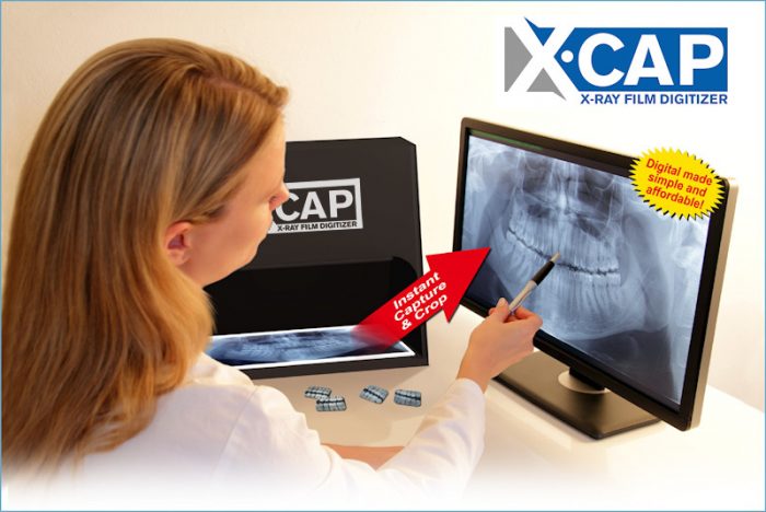 Information Capture Solutions | ICS X-Cap X-Ray Scanning